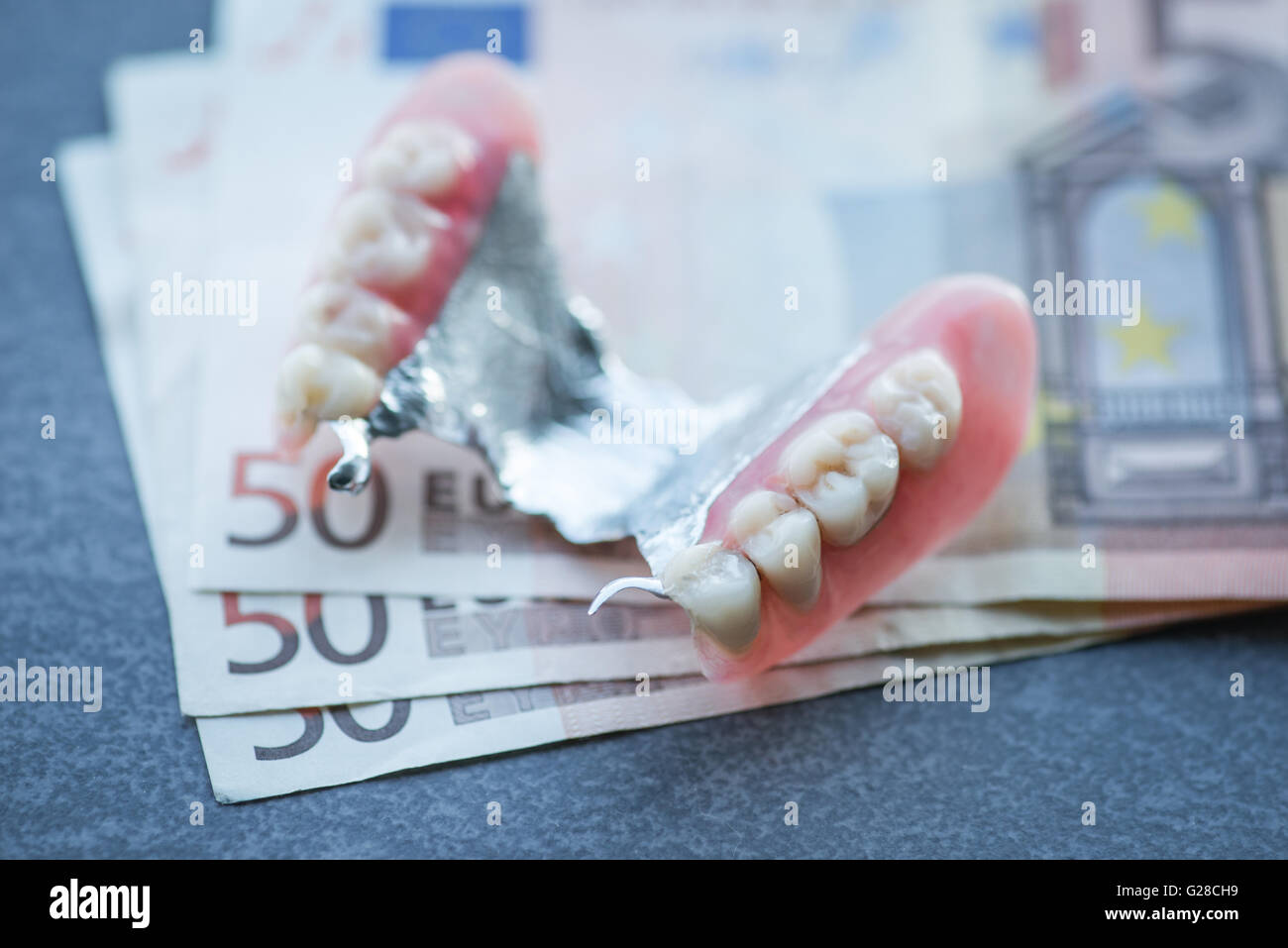 Teeth mold hi-res stock photography and images - Alamy