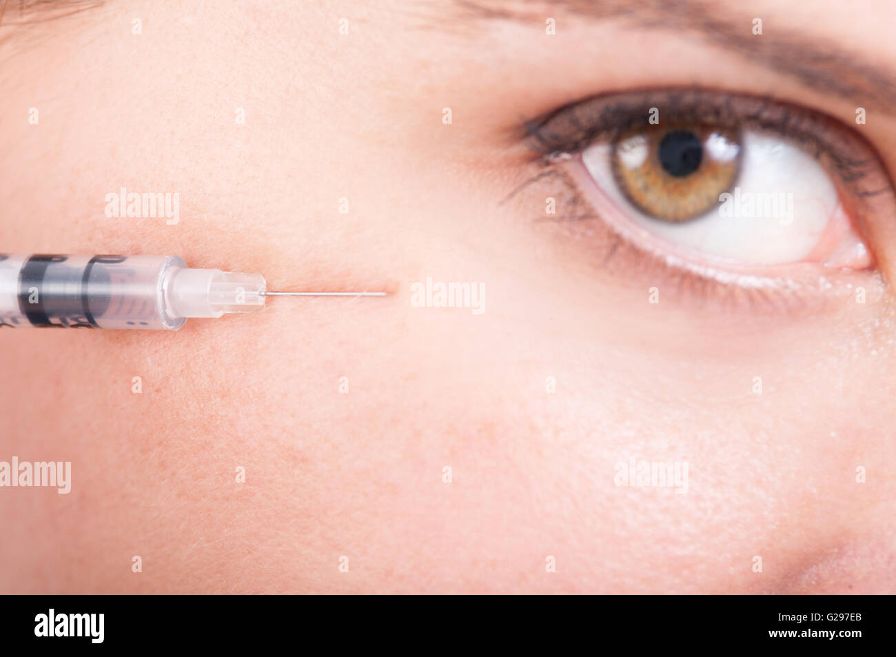 Botox for eyes wrinkle. Closeup view with syringe needle Stock Photo ...