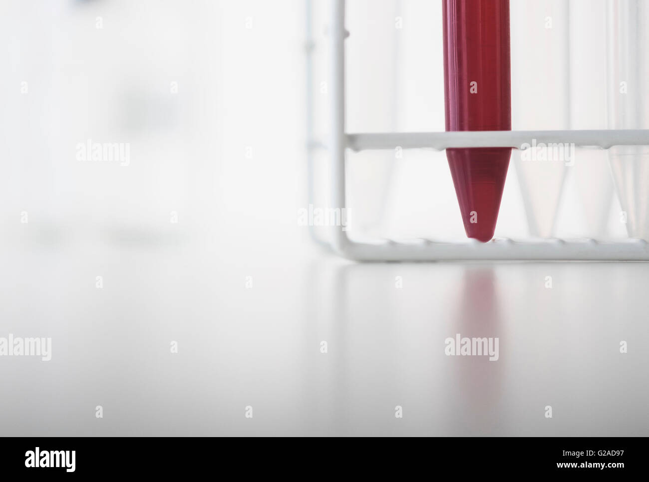Blood sample in test tube Stock Photo - Alamy