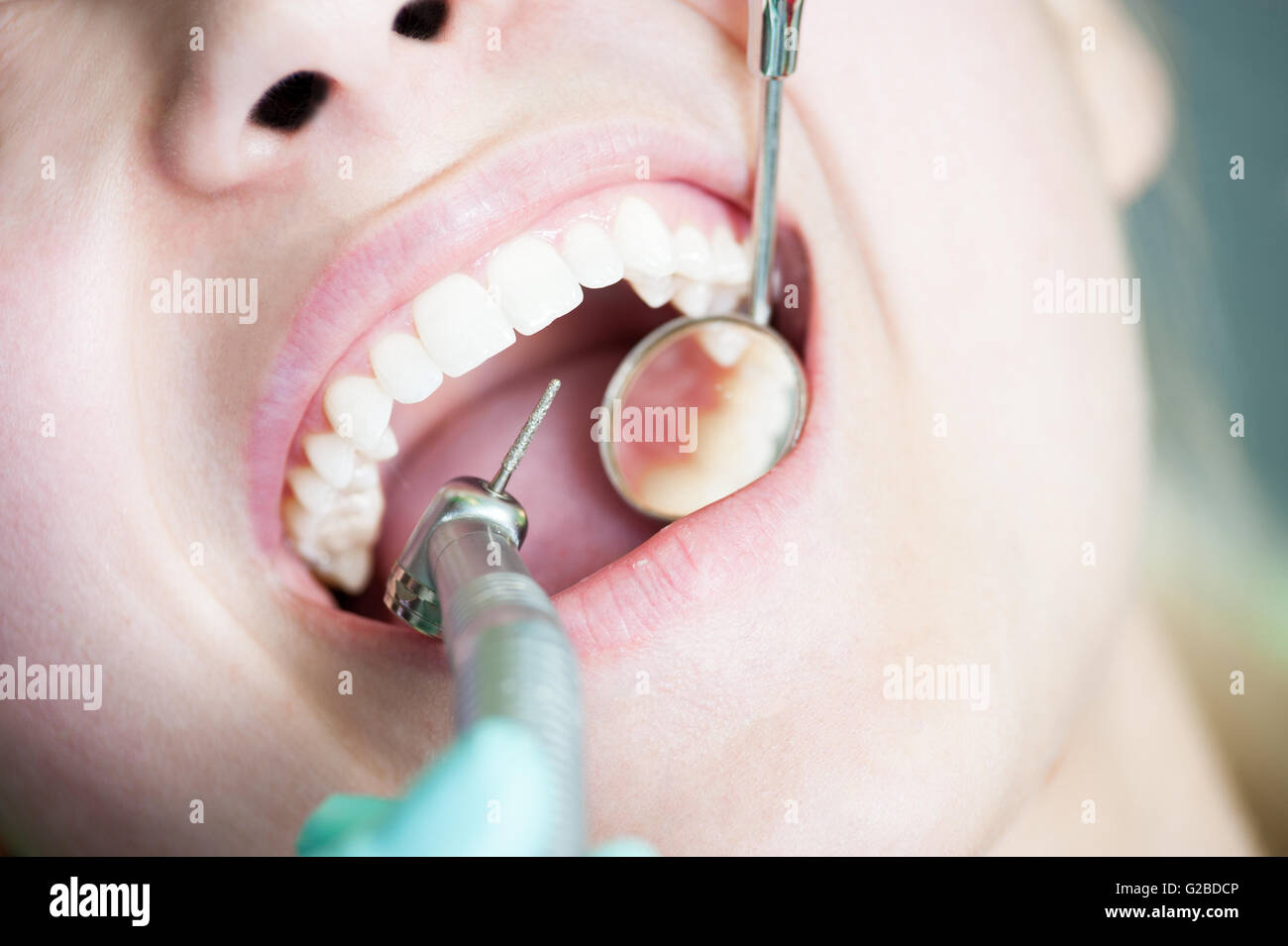Dental drilling procedure on beautiful teeth and open mouth Stock Photo ...