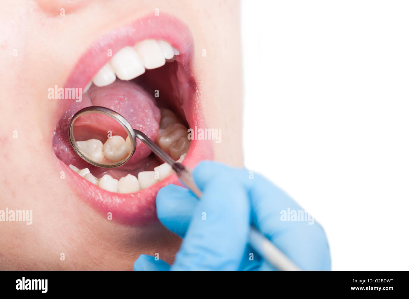 Close-up of woman patient with open mouth at the dentist office ...