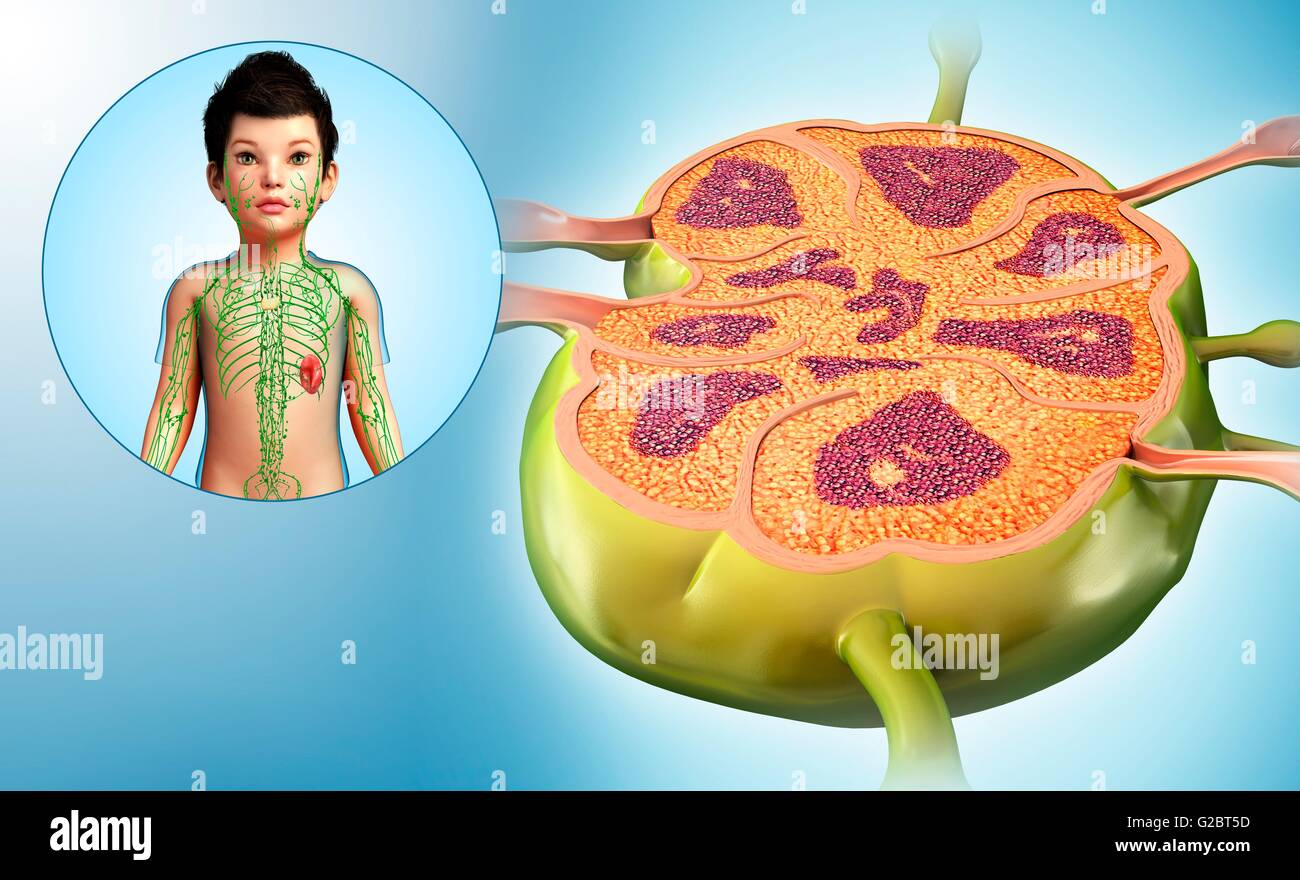 Lymph node of a child, illustration Stock Photo - Alamy