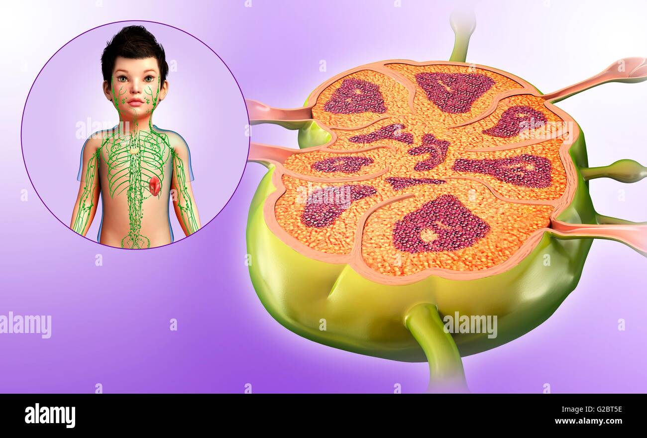 Lymph node of a child, illustration Stock Photo - Alamy