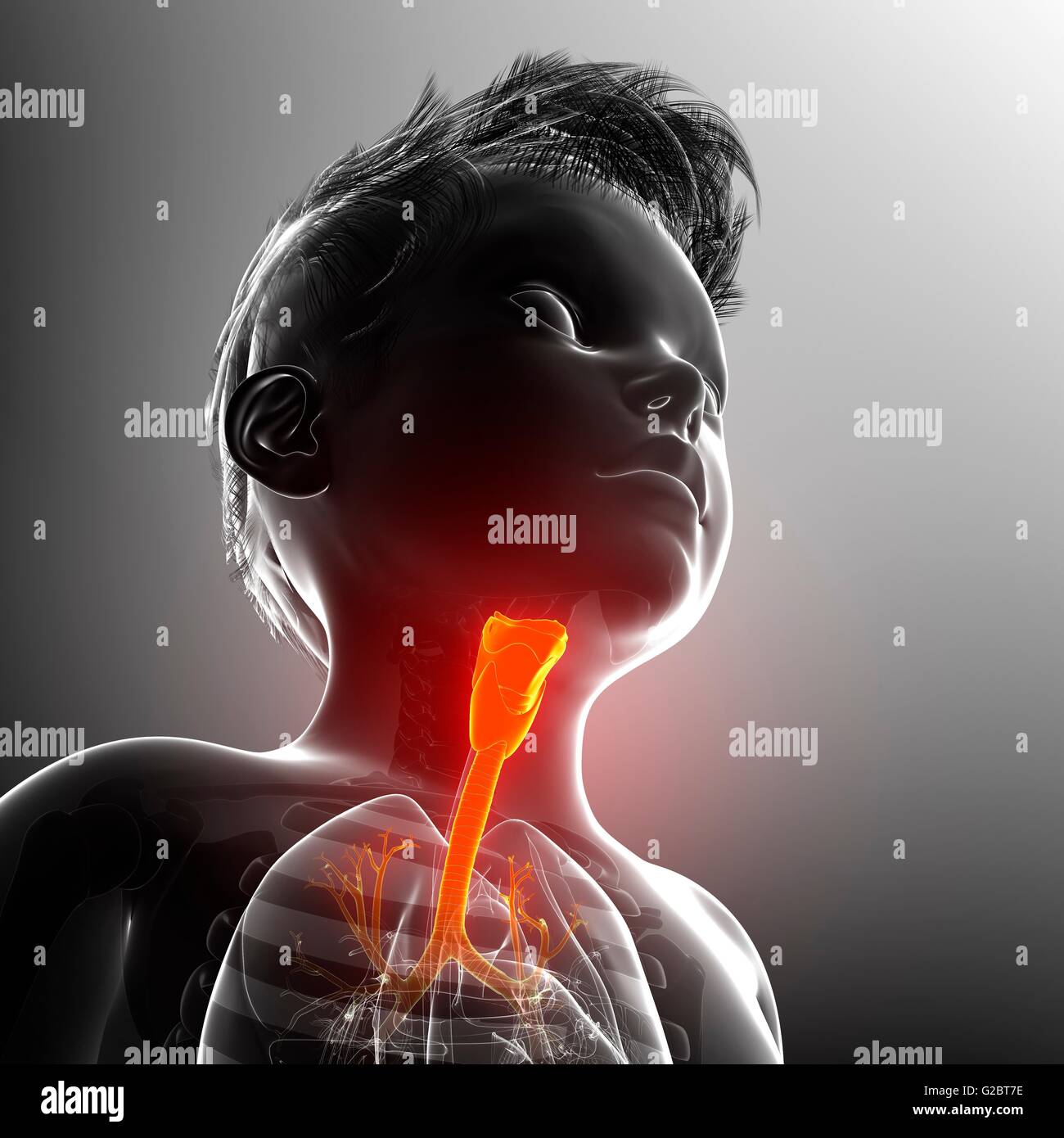 Thyroid of a child hi-res stock photography and images - Alamy