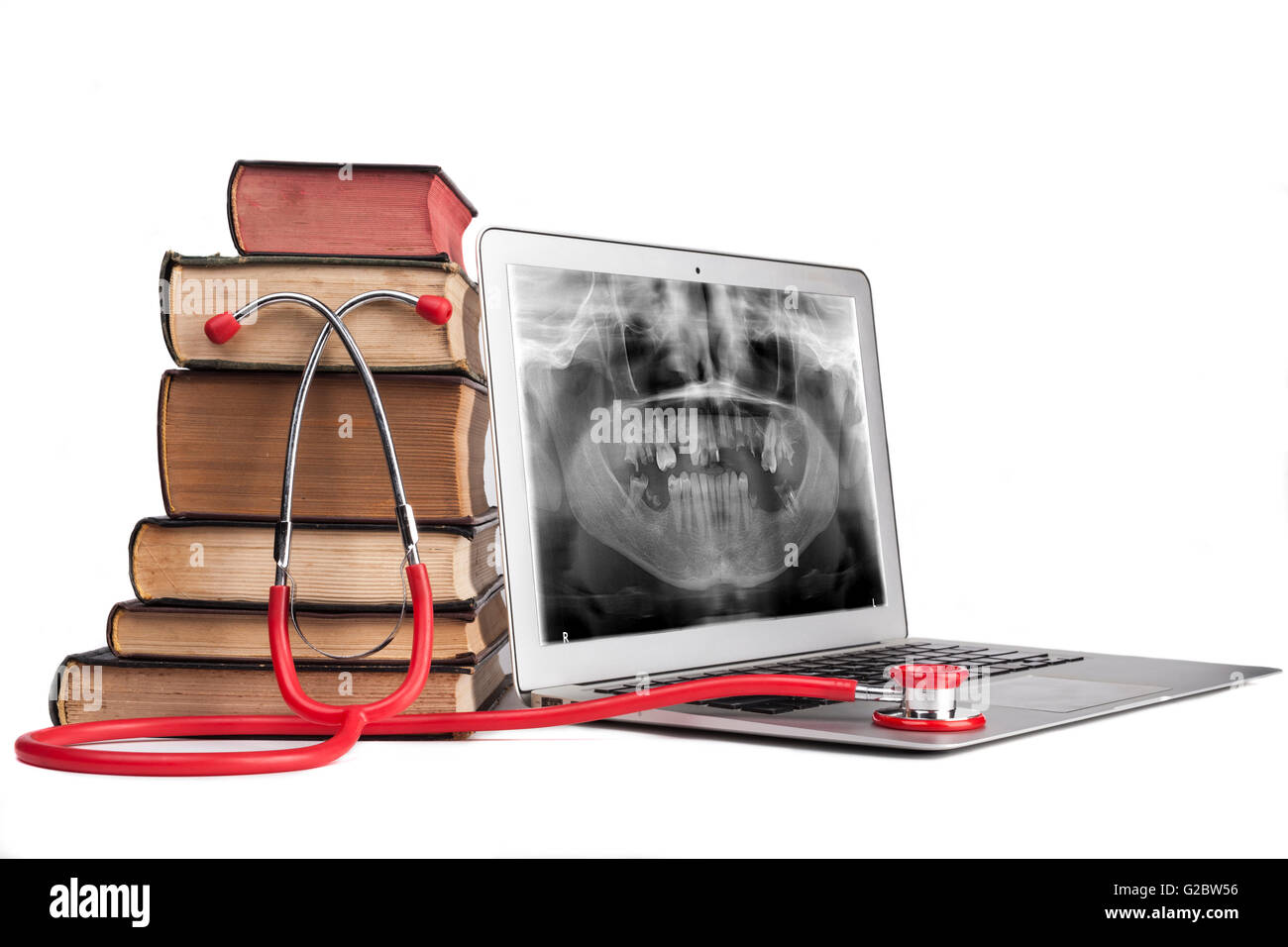 Old Books and xray on silver laptop and red stethoscope isolated on ...
