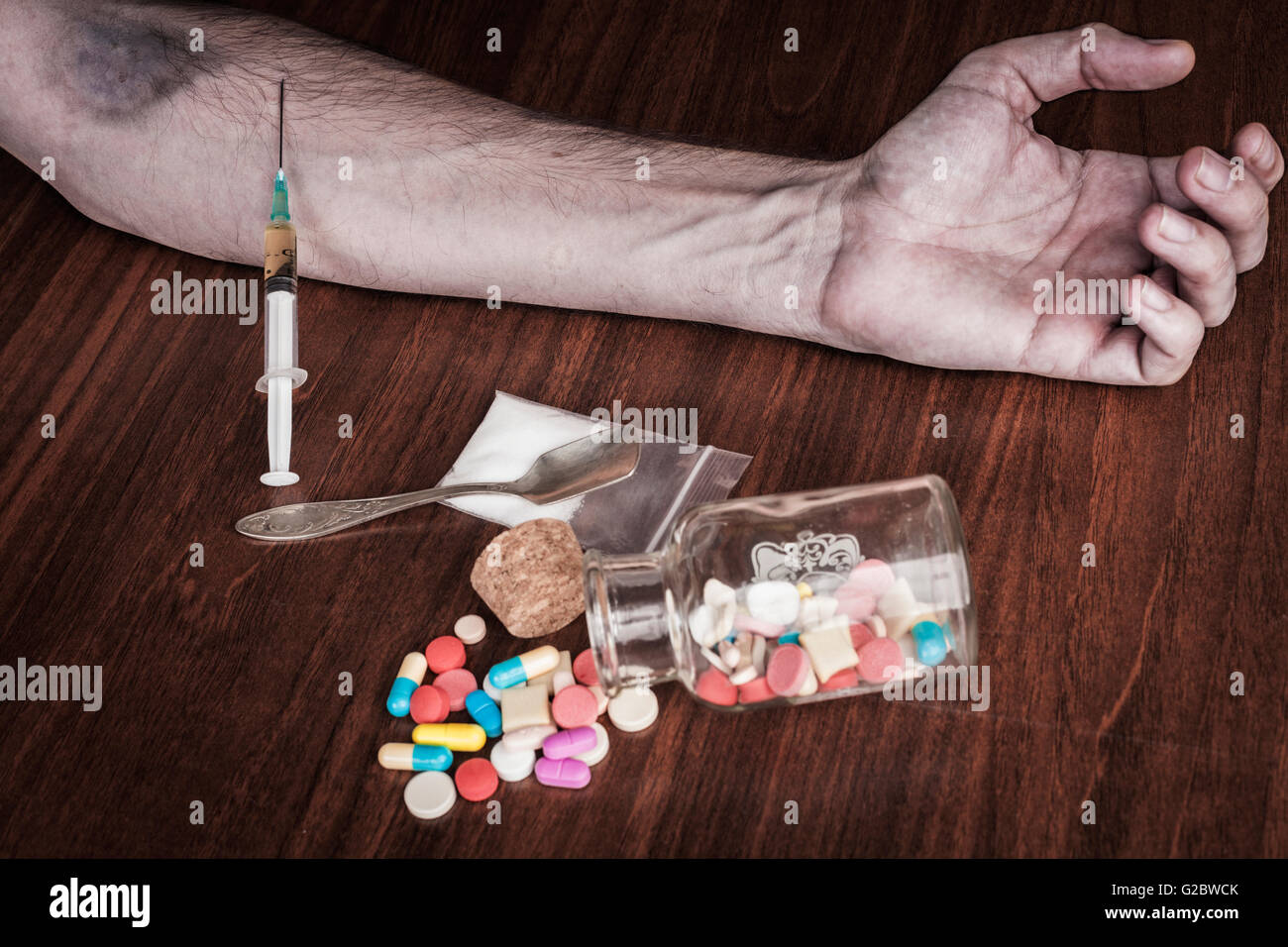 Vein bruise hi-res stock photography and images - Alamy