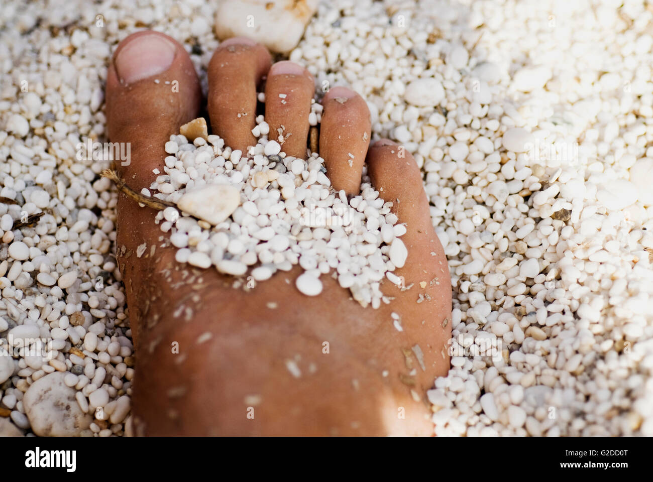 Foot With Small Granular Rocks at Beach Stock Photo - Alamy