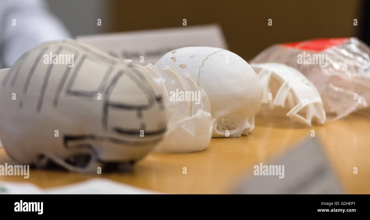 Hanover, Germany. 30th May, 2016. Models of the skull of patient Emil ...