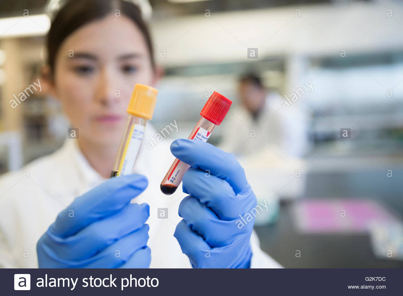 Woman blood sample scientist hi-res stock photography and images - Alamy