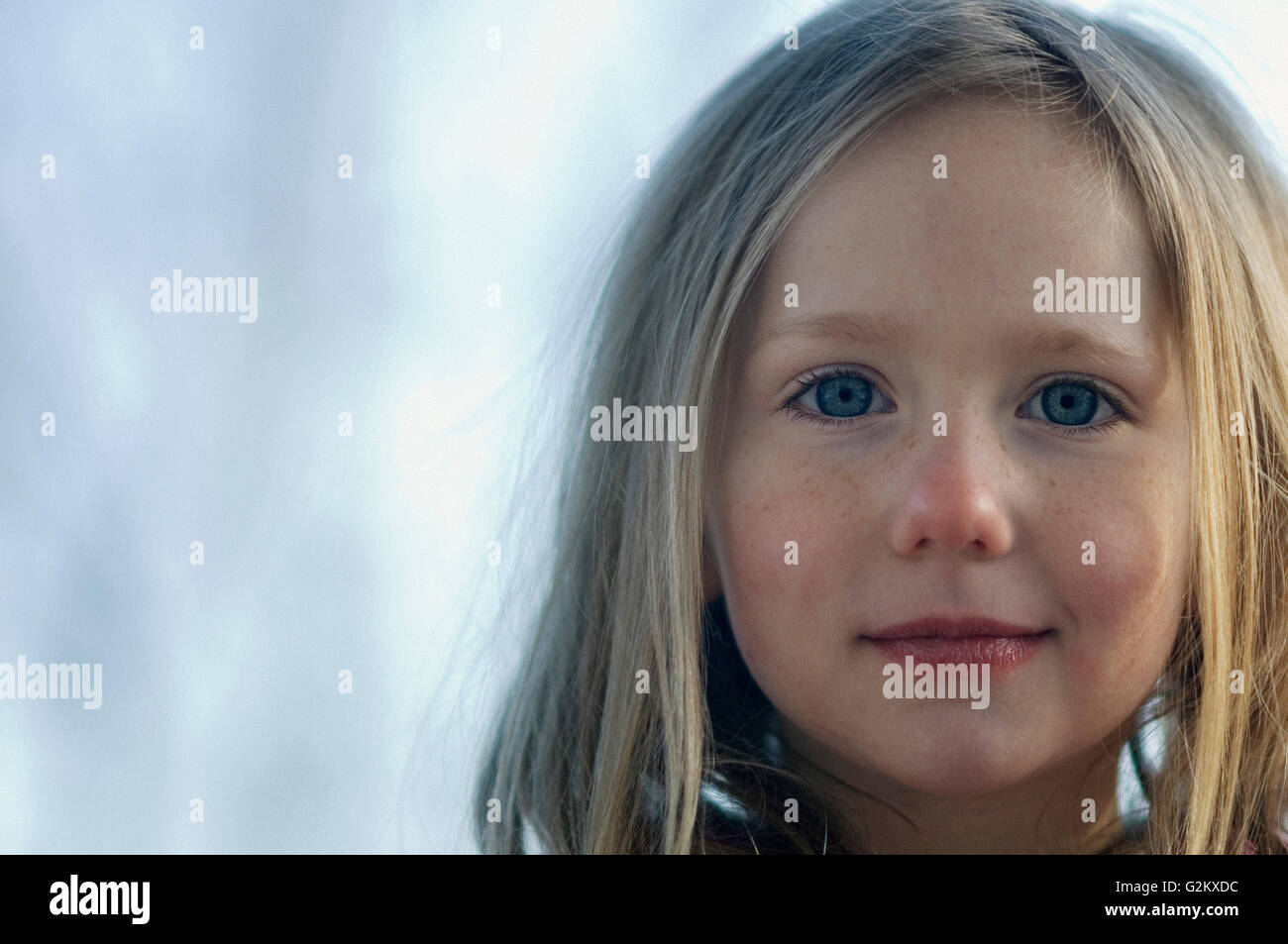 Children chapped lips hi-res stock photography and images - Alamy