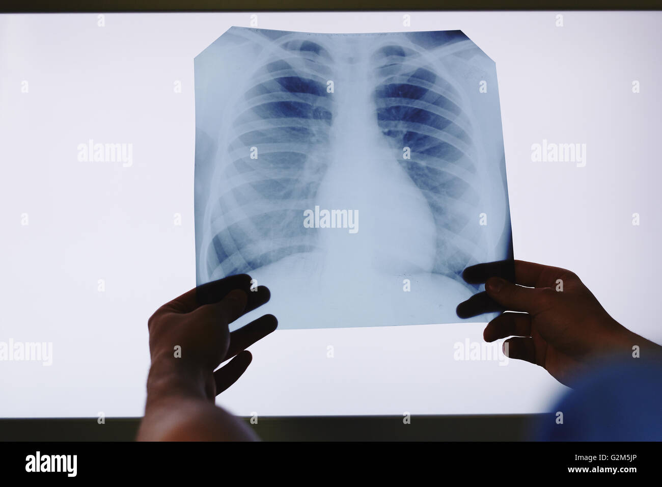 Radiology x ray hi-res stock photography and images - Alamy