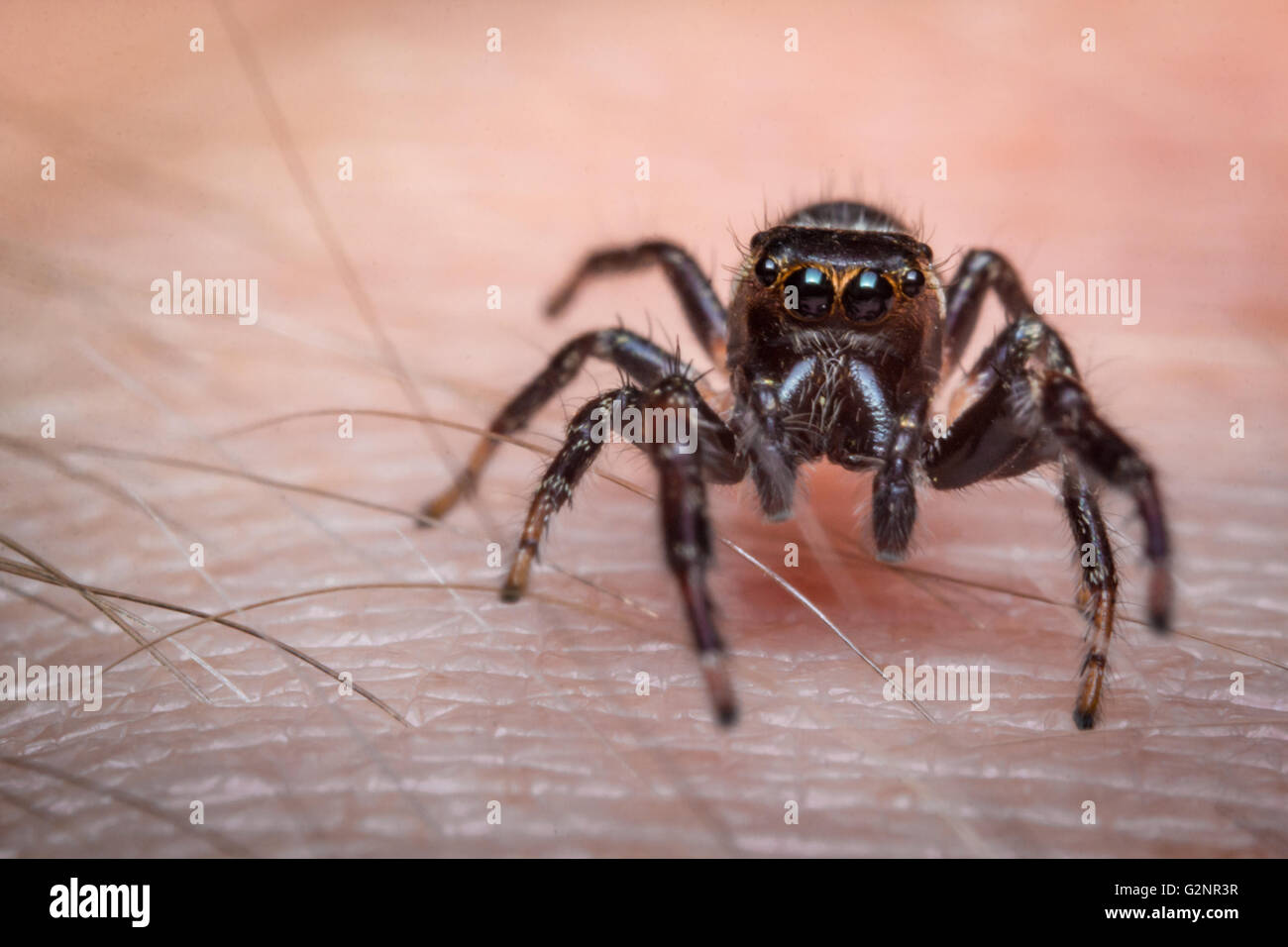 Spider bite human hi-res stock photography and images - Alamy