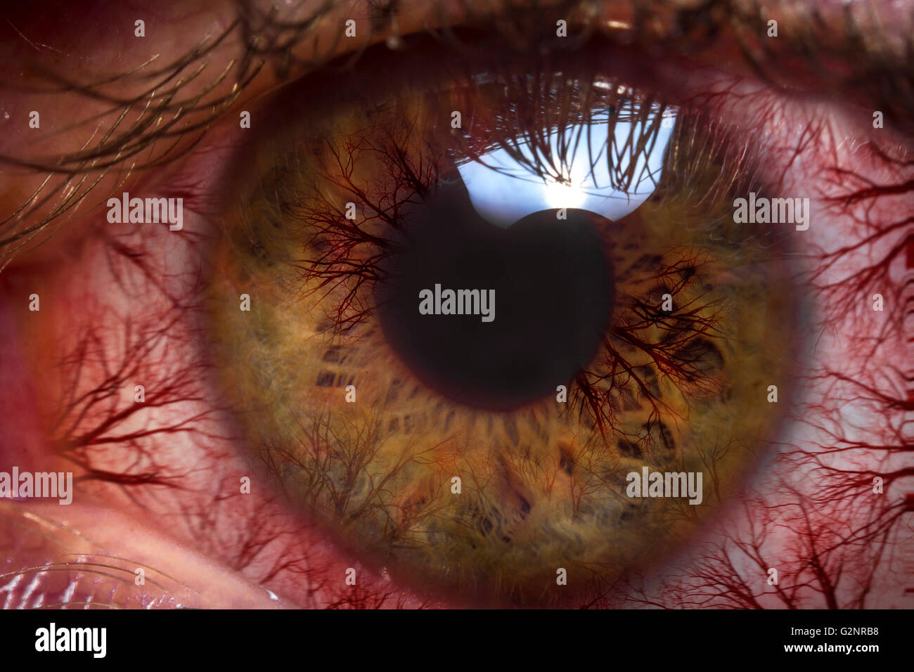 Bloodshot eyeball hi-res stock photography and images - Alamy