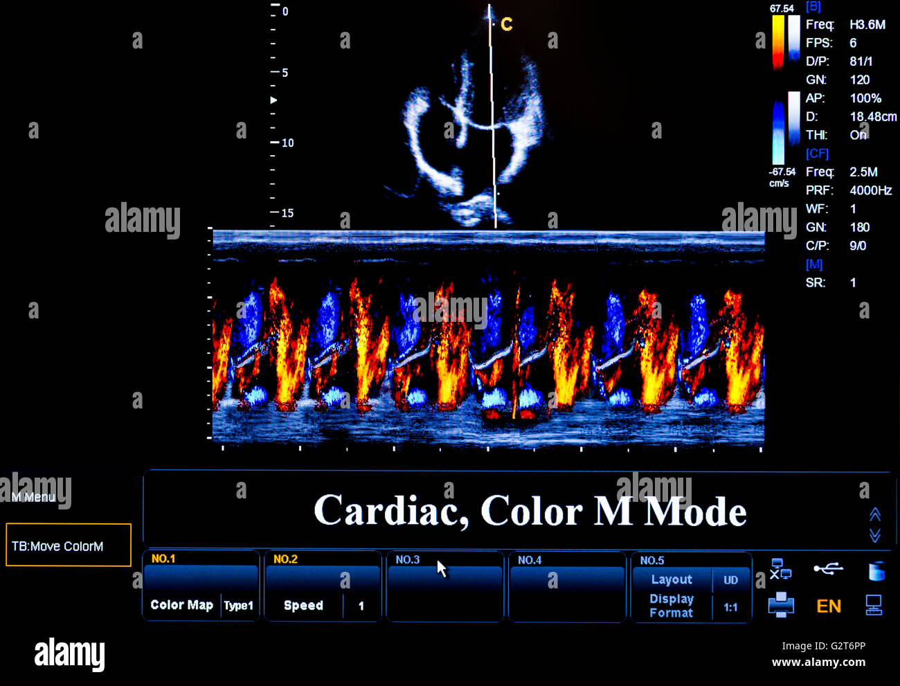 Modern echocardiography (ultrasound) machine monitor. Colour image. New ...