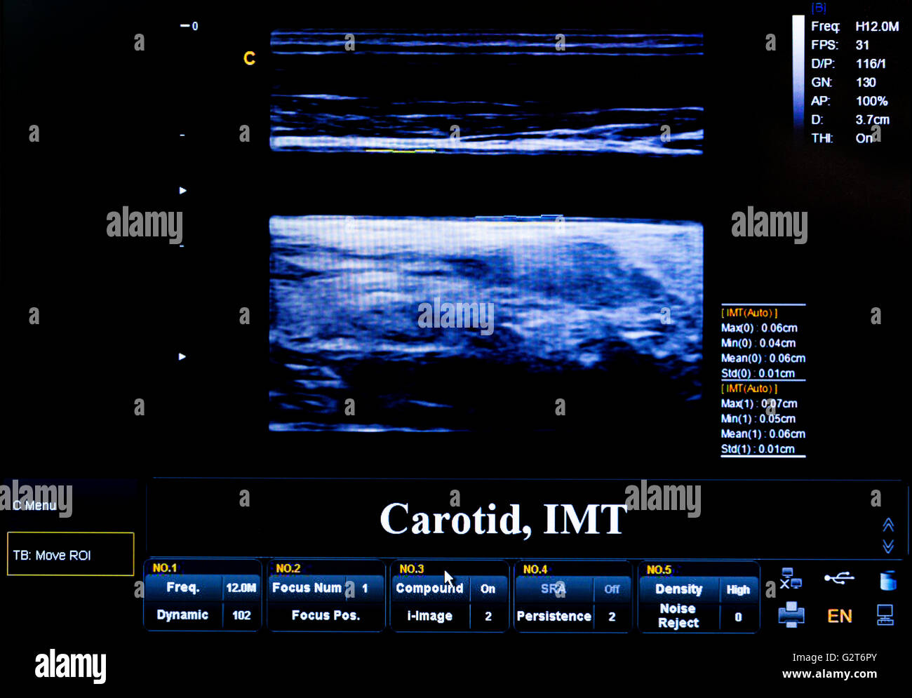 Modern echocardiography (ultrasound) machine monitor. Colour image. New ...