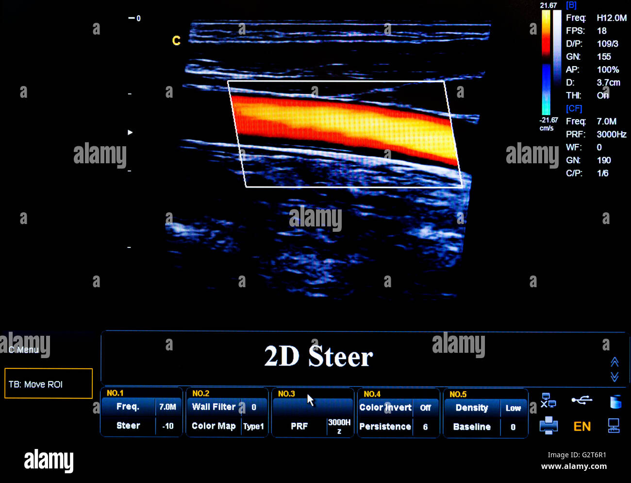 Modern echocardiography (ultrasound) machine monitor. Colour image. New ...
