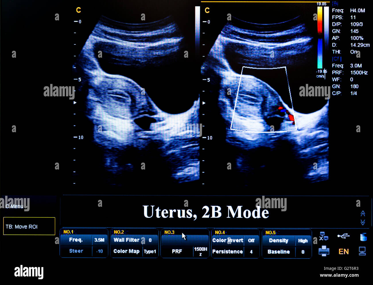 Modern echocardiography (ultrasound) machine monitor. Colour image. New ...