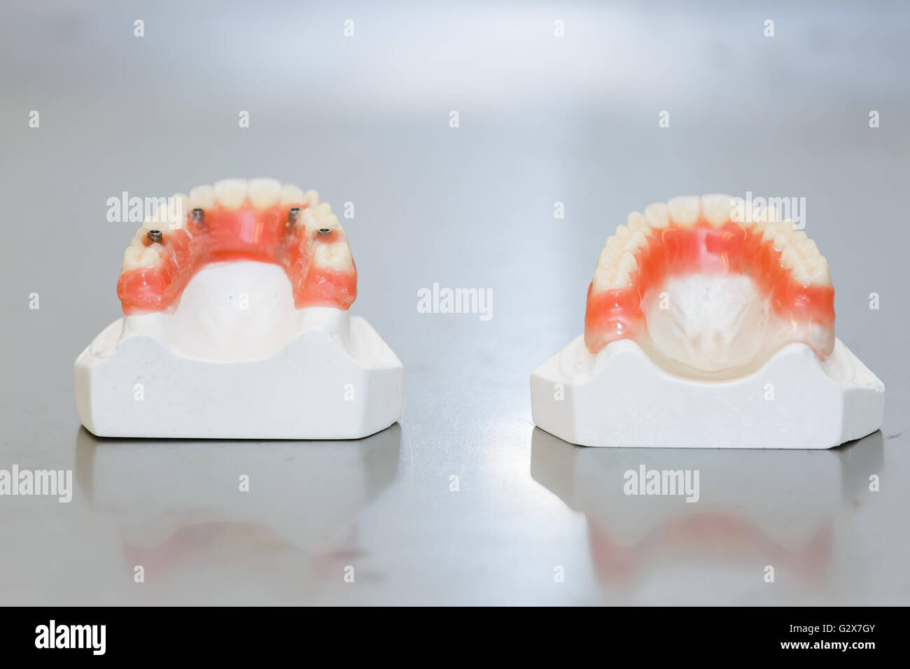 Upper and Lower False Teeth Stock Photo - Alamy