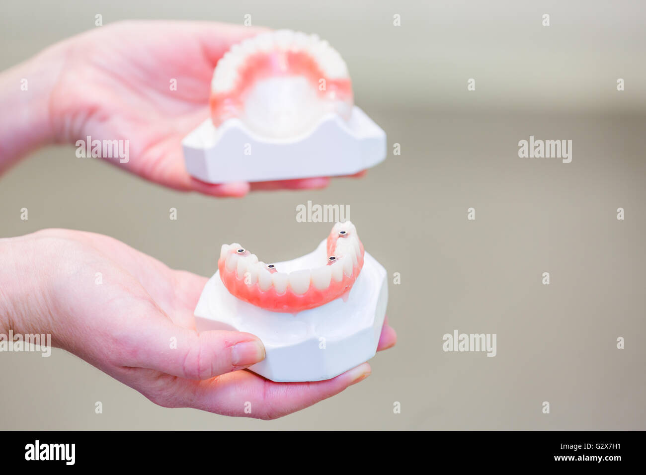 Hand holding a set of dentures Stock Photo - Alamy