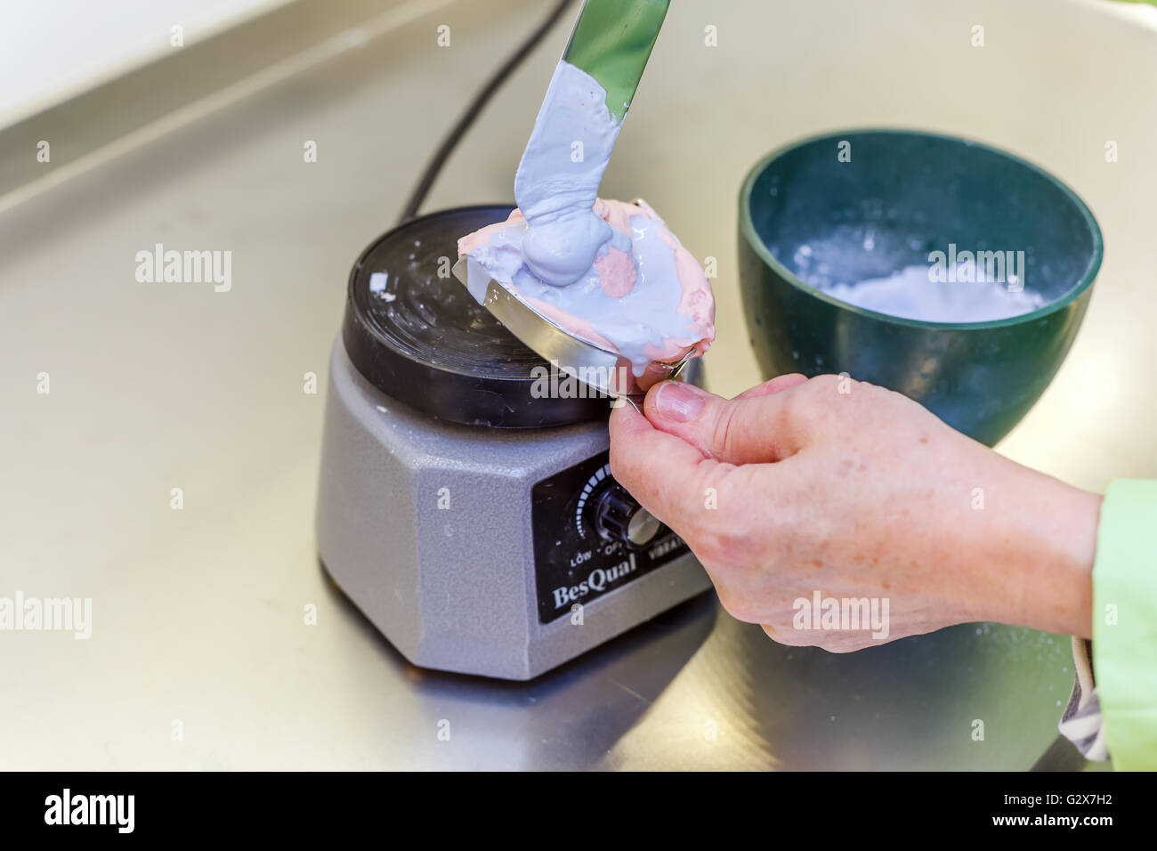 Dental impression in dental laboratory Stock Photo - Alamy