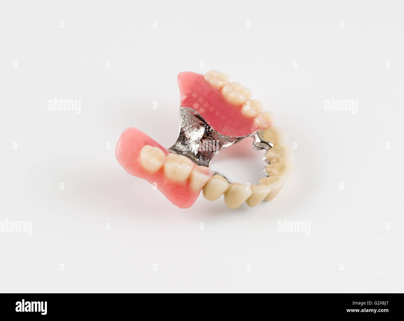 Clasp prosthesis with and attachments fixing ceramic crowns Stock Photo ...