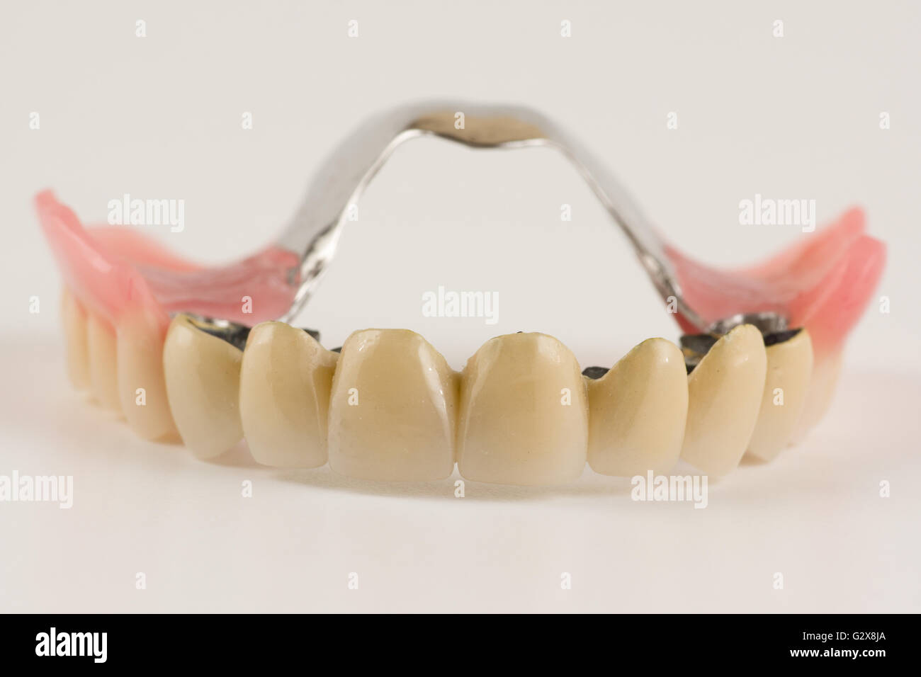 Clasp prosthesis with and attachments fixing ceramic crowns Stock Photo ...