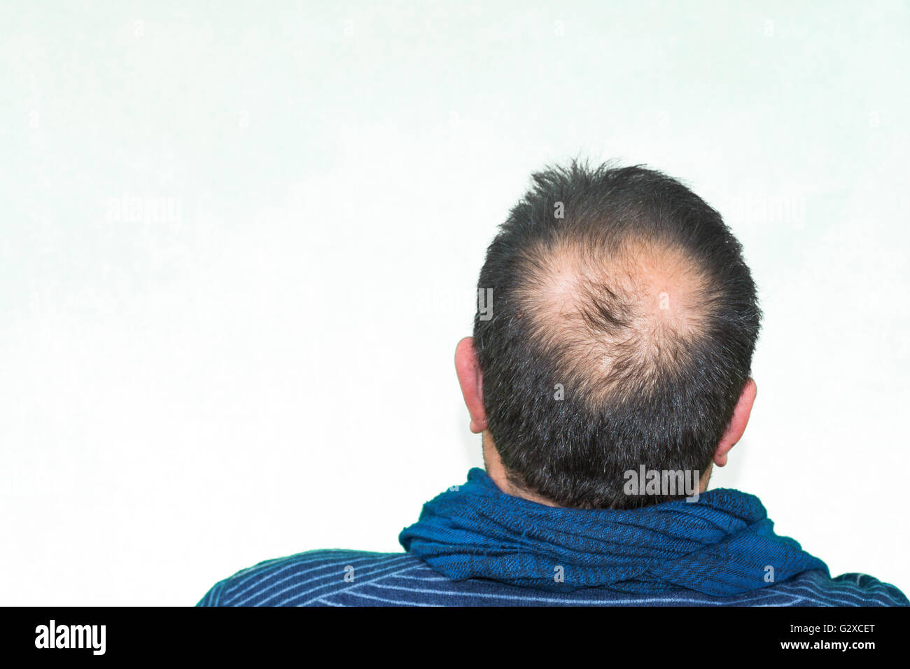 Bald head close up from behind hi-res stock photography and images - Alamy