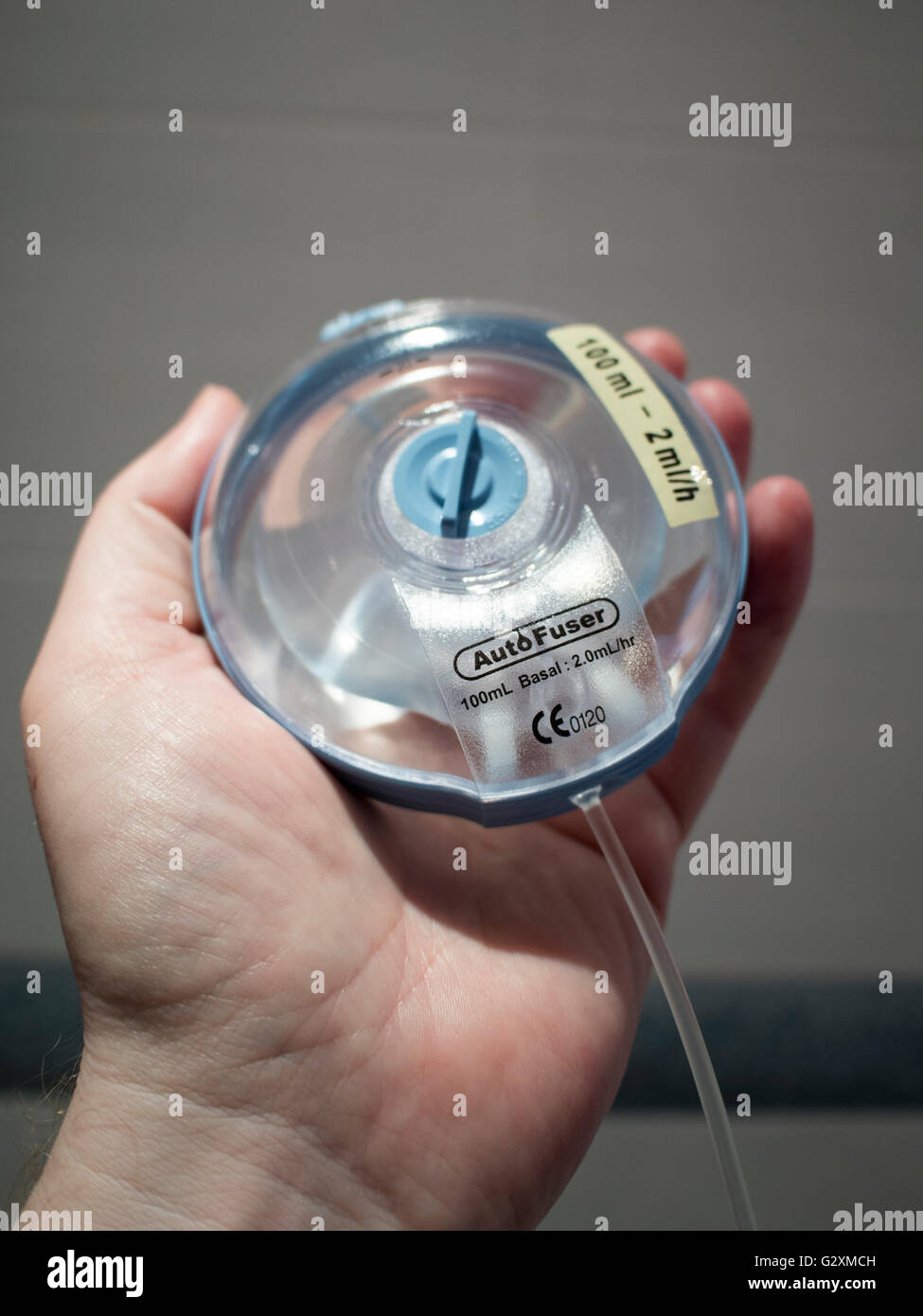 An Auto Fuser chemotherapy pump Stock Photo - Alamy