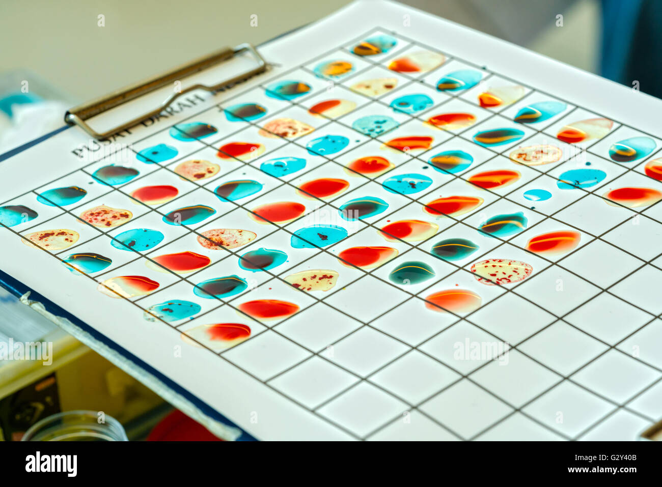 Leukemia test hi-res stock photography and images - Alamy