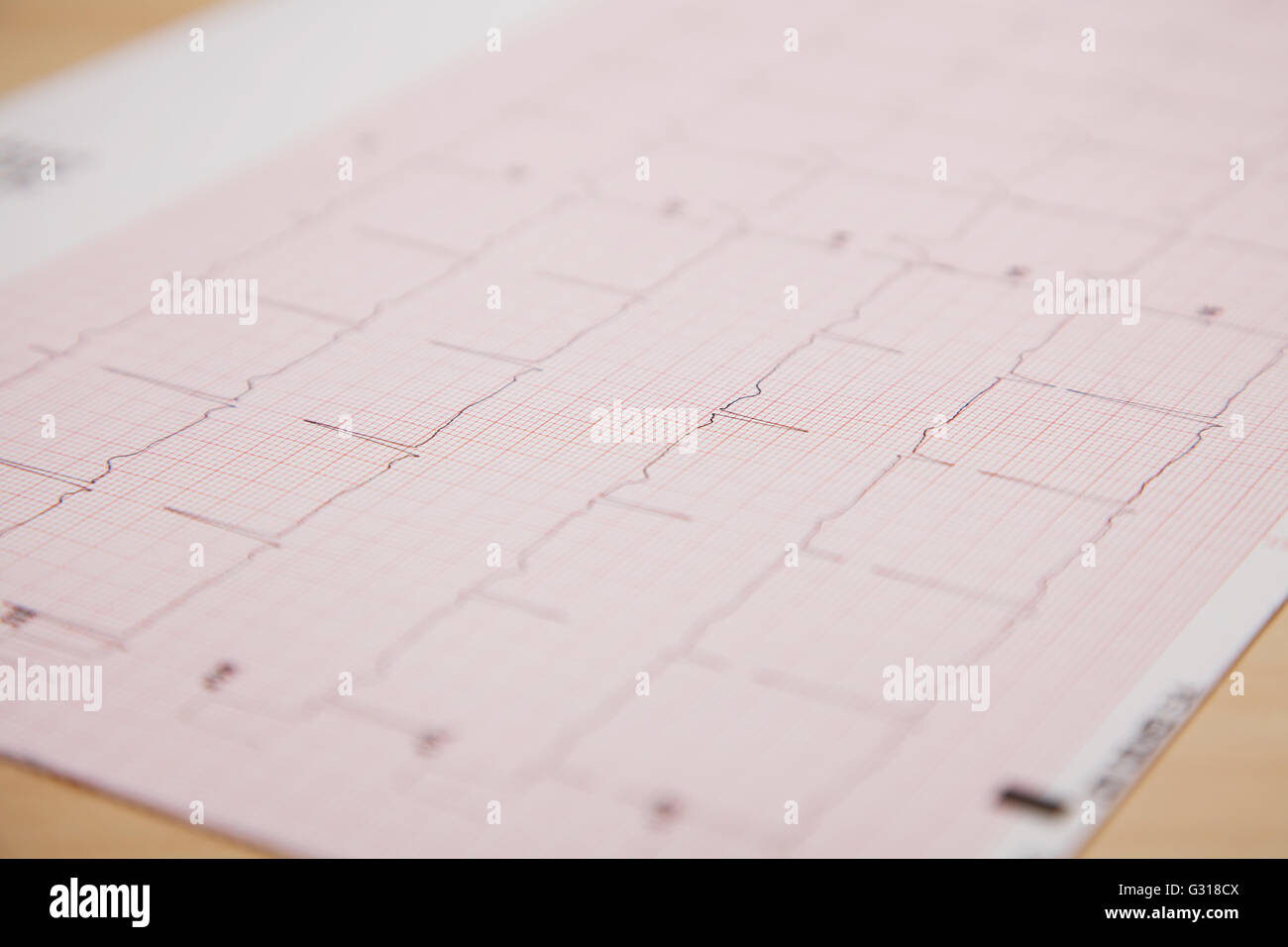 Medical report and cardiogram Stock Photo - Alamy
