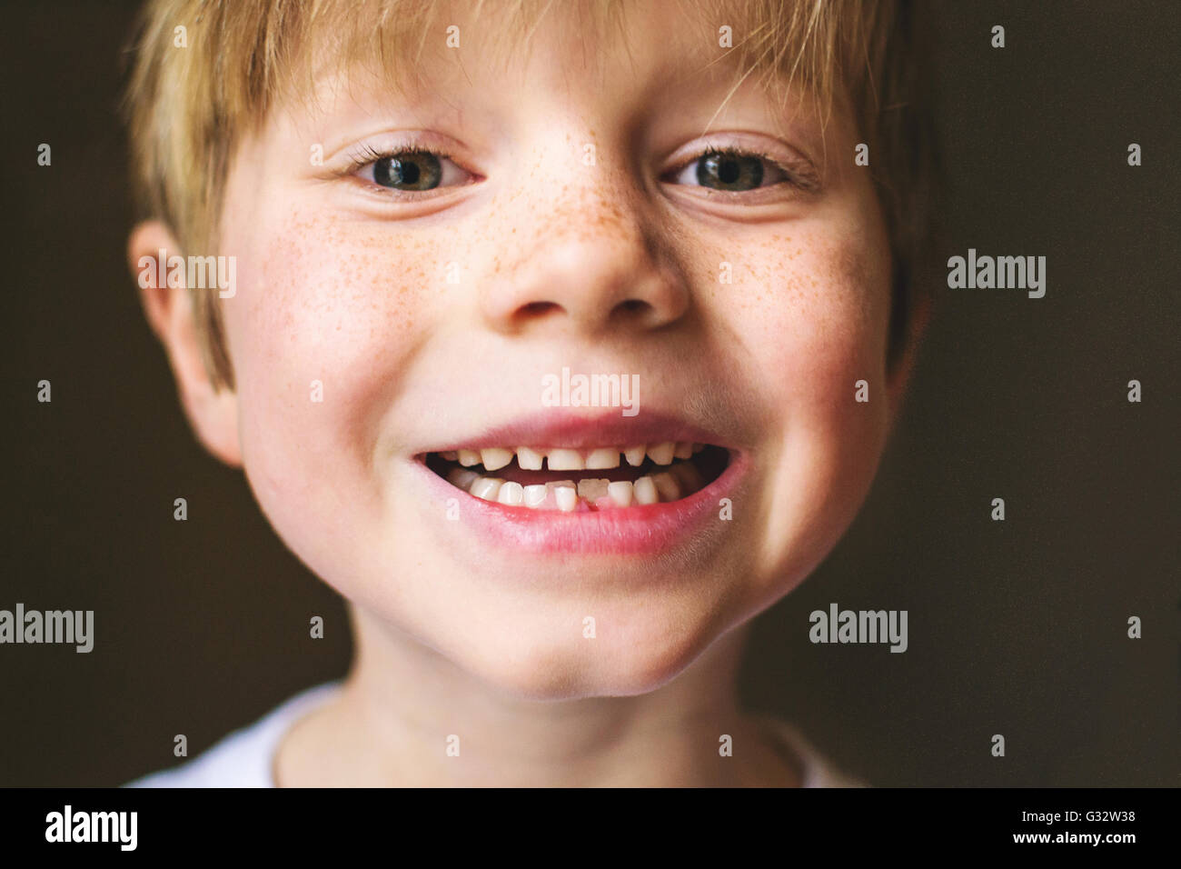 One tooth missing hi-res stock photography and images - Alamy