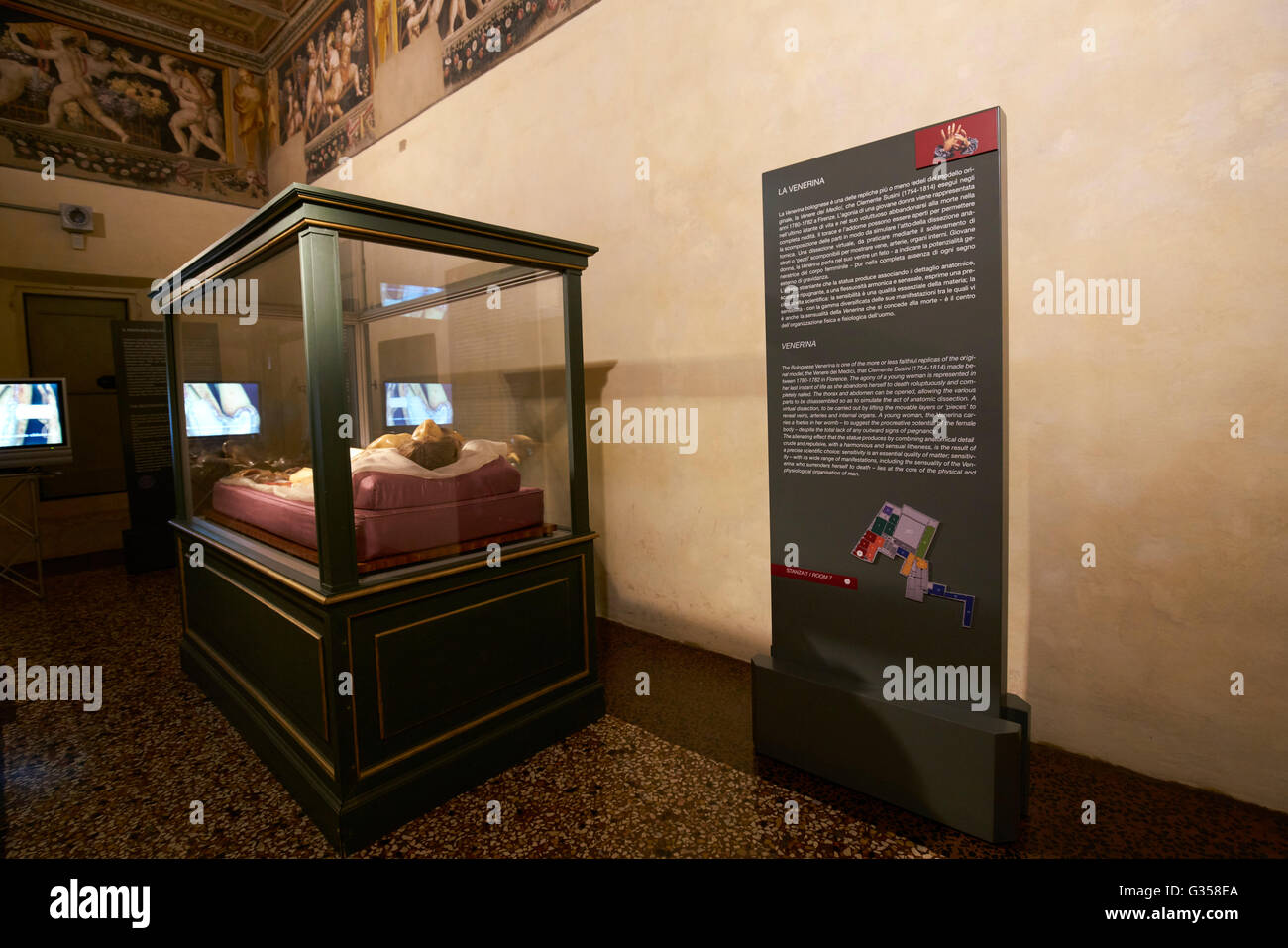 Anatomical models at the Poggi Museum (Museo Poggi) in the Palazzo ...