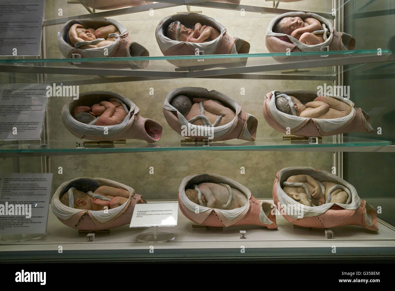 Anatomical models of obstetrics at the Poggi Museum (Museo Poggi) in ...