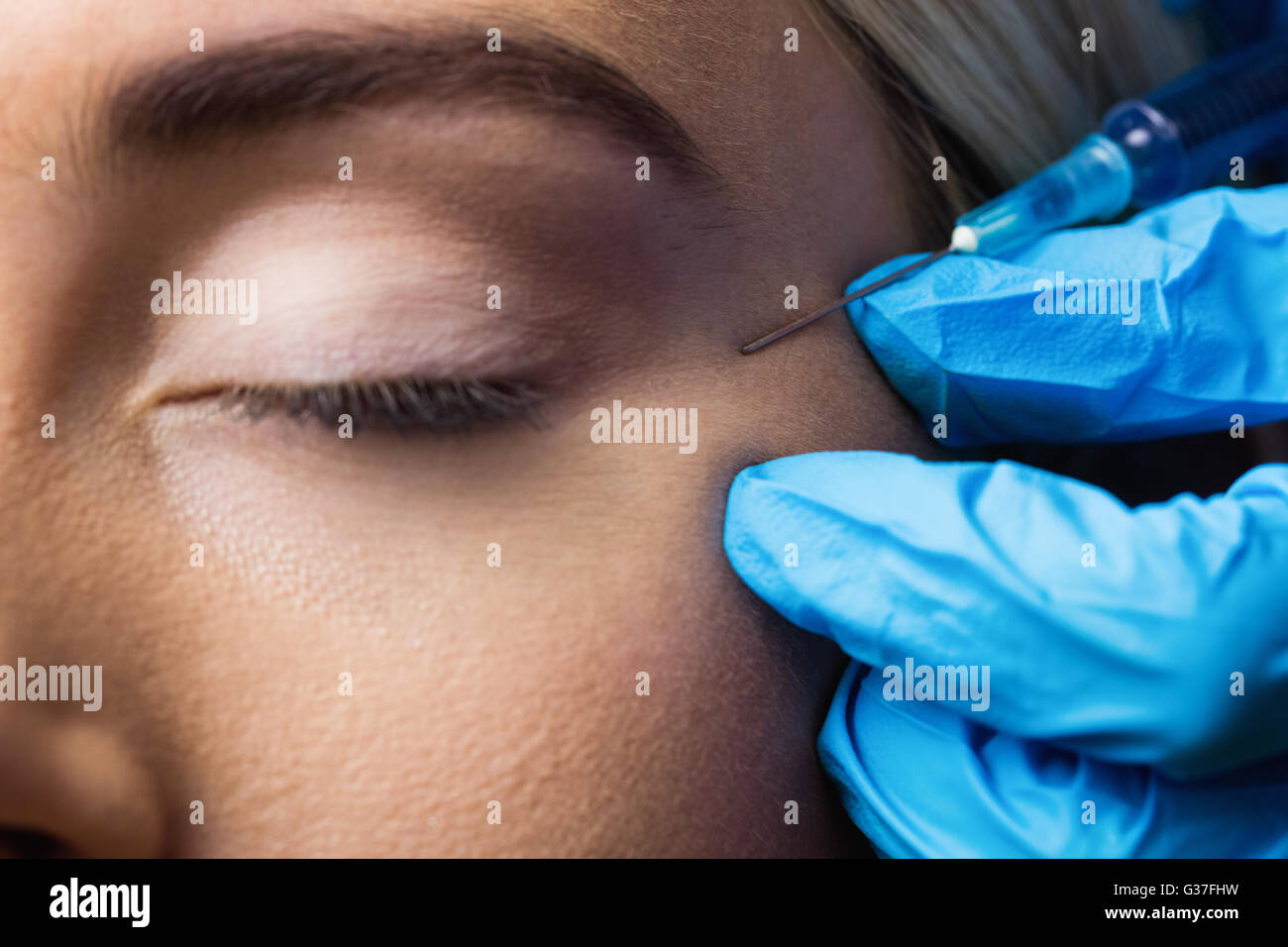 Woman receiving botox injection on her forehead Stock Photo - Alamy