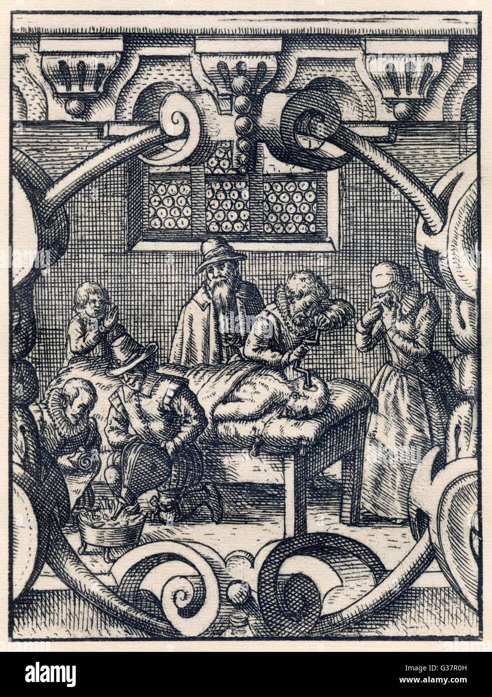 Trepanning operation High Resolution Stock Photography and Images - Alamy