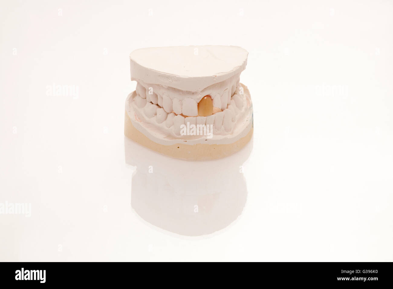 Denture plaster hi-res stock photography and images - Alamy