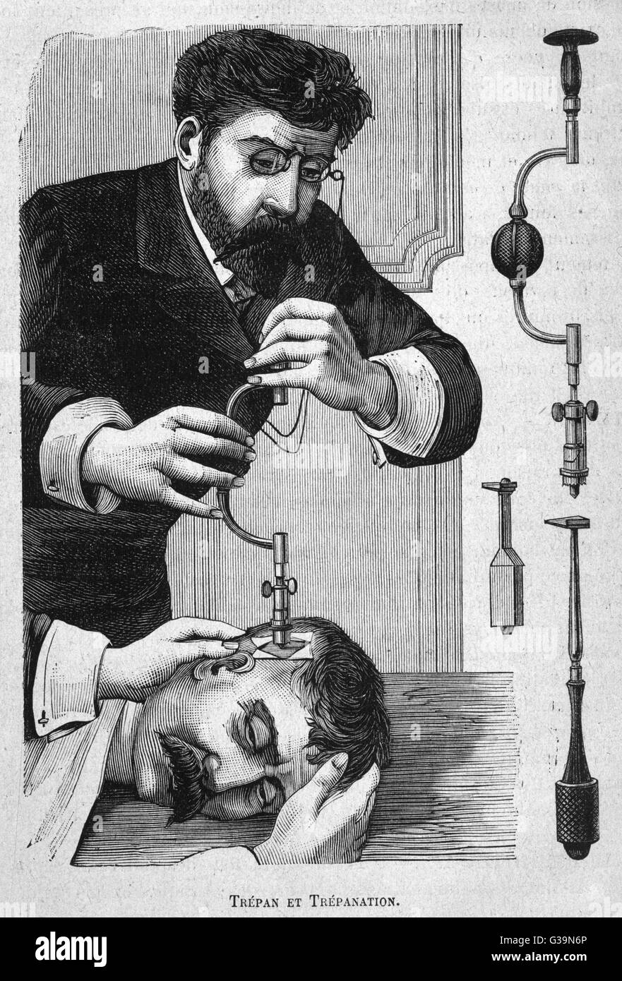 Trepanation Tool
