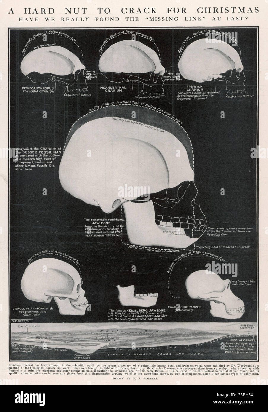 Piltdown man diagram the cranium jaw bone hi-res stock photography and ...