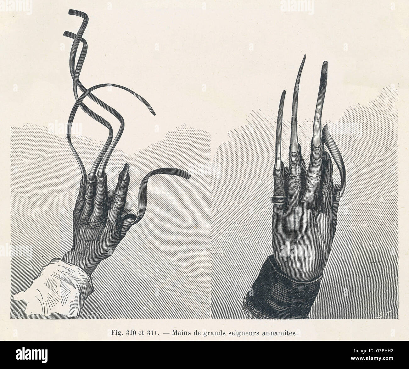 Overgrown fingernails hi-res stock photography and images - Alamy