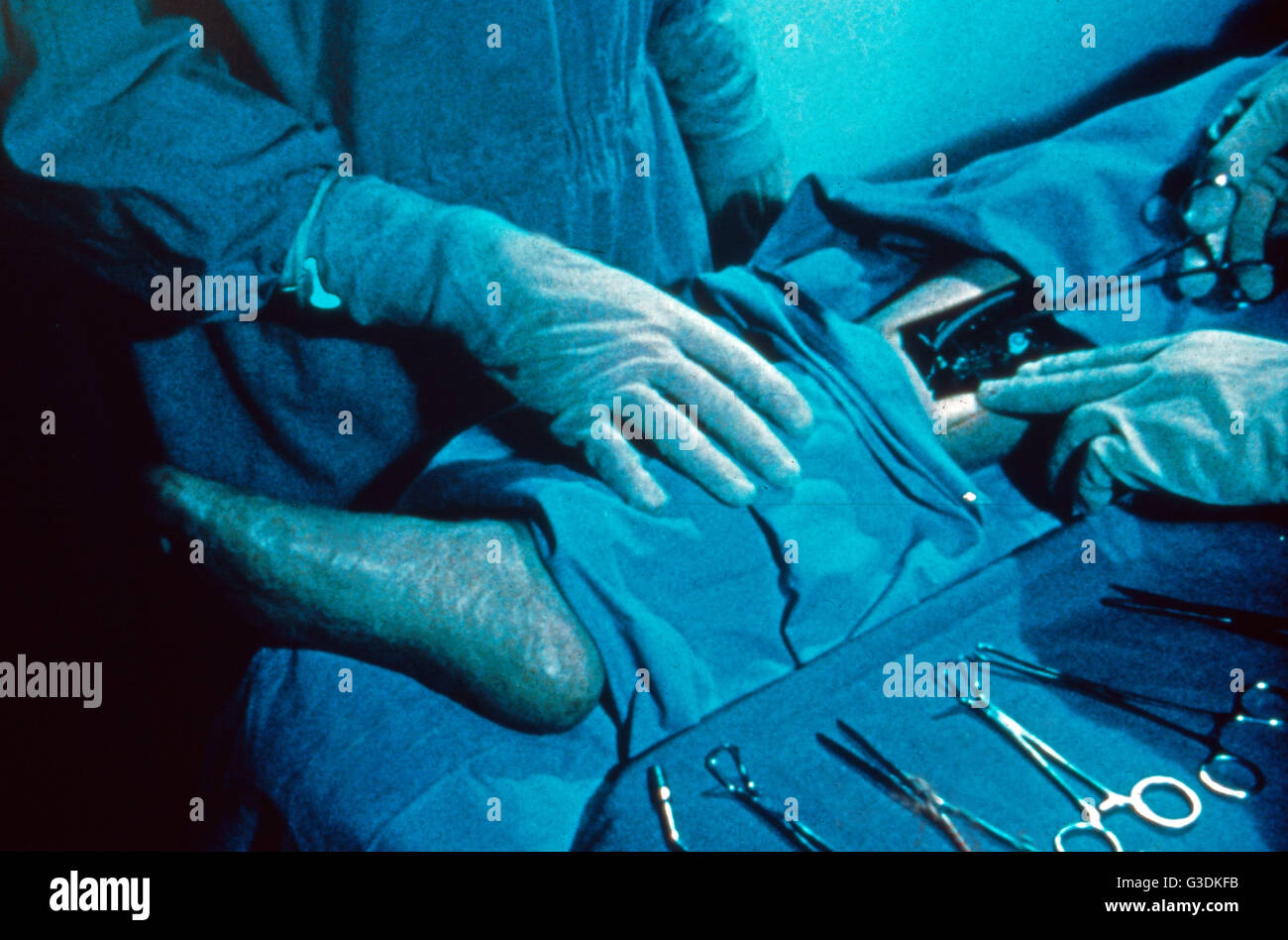 The six million dollar man hi-res stock photography and images - Alamy