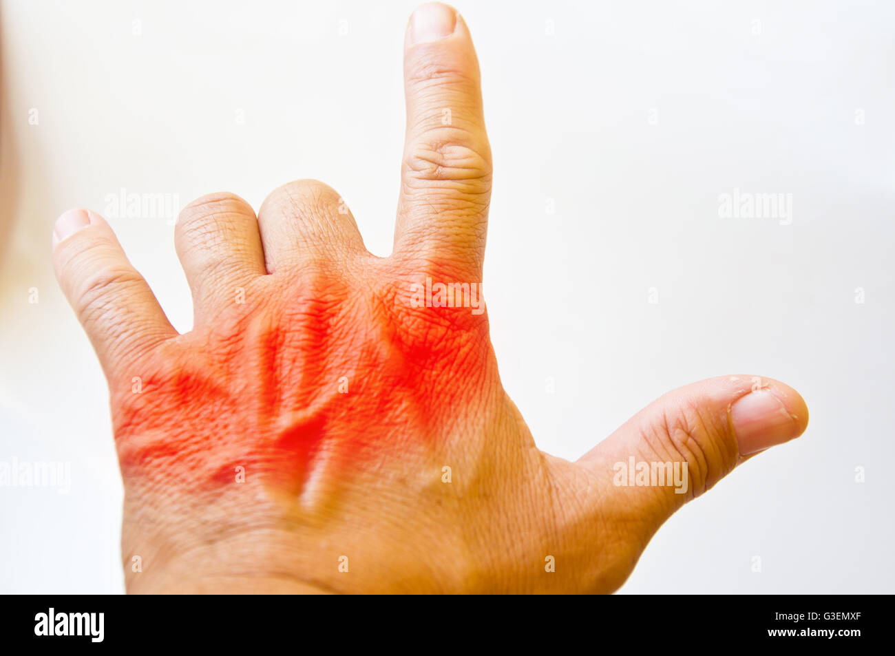 back hand pain from adult on white background Stock Photo - Alamy