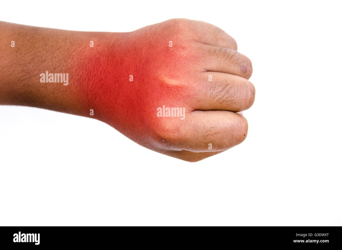 children fist with pain on white background Stock Photo - Alamy
