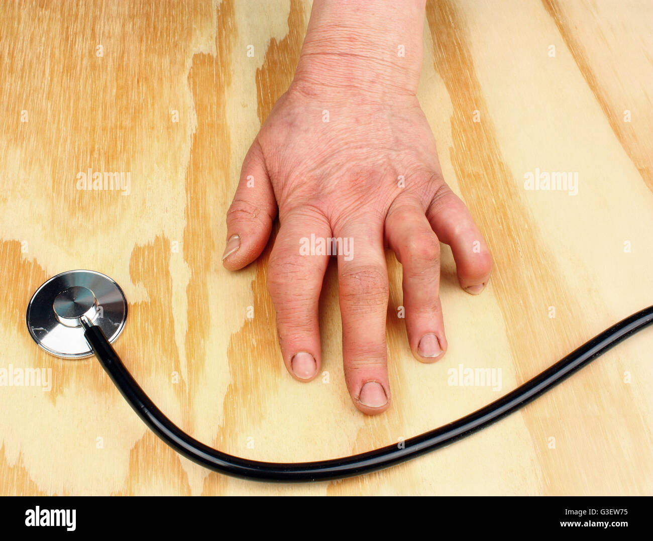 Deformed anatomy hi-res stock photography and images - Alamy