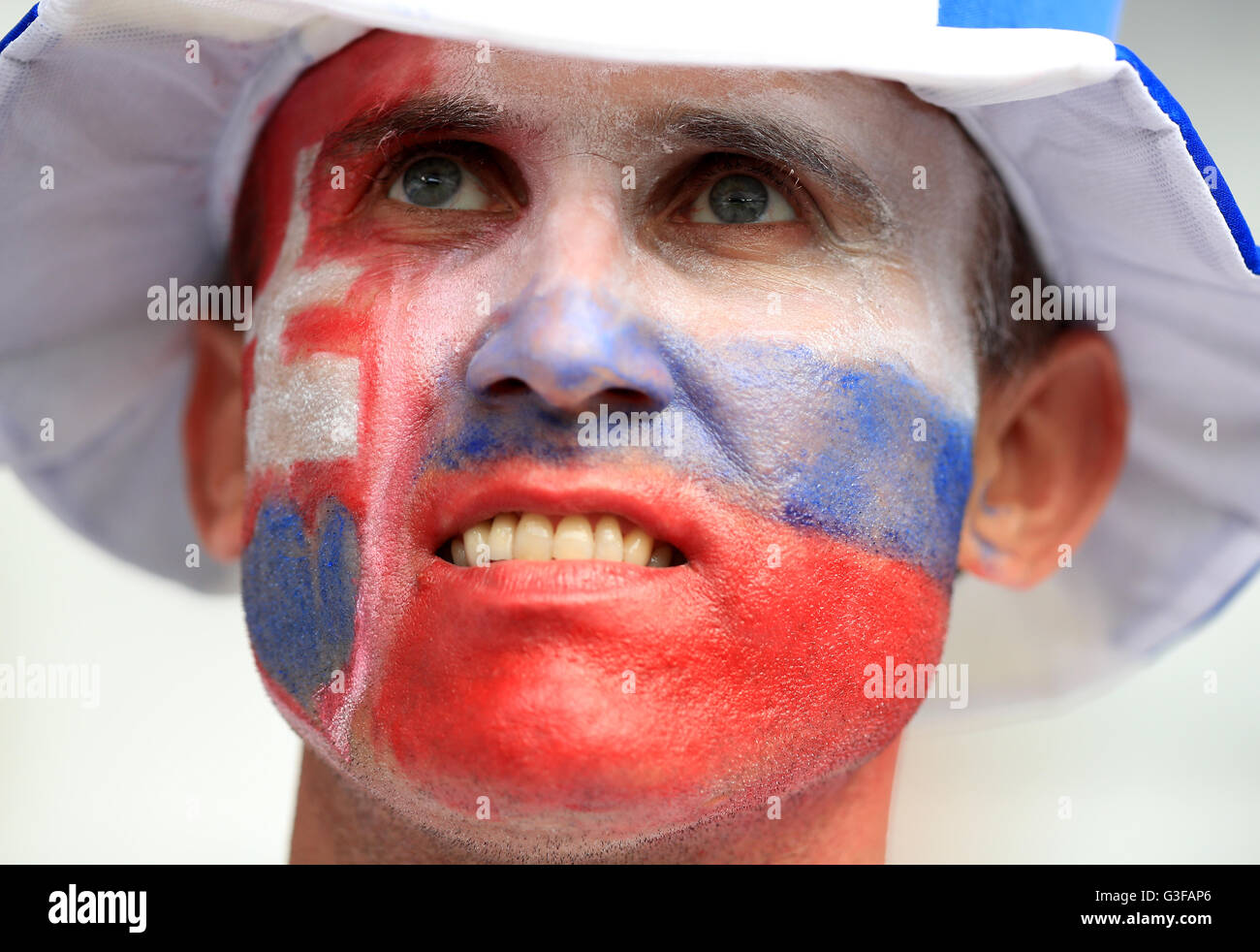 A Slovakia fan wears face paint in support of his team before the UEFA ...
