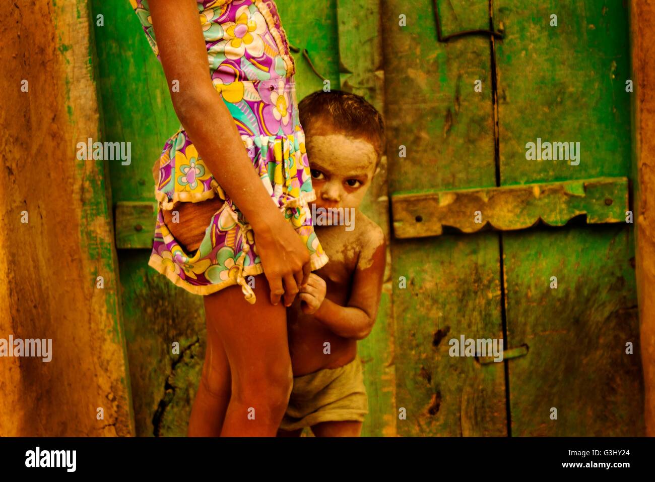 Famine like condition hi-res stock photography and images - Alamy
