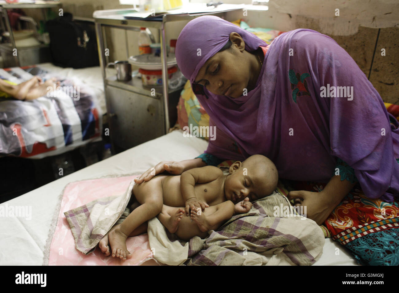 Dhaka, Bangladesh. 13th June, 2016. Parasitic Twin named Mohammad Ali ...