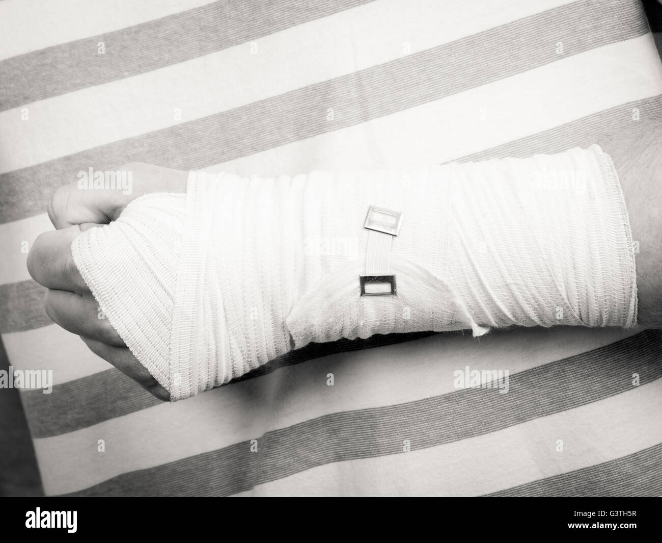 Fractures and dislocations concept. Part body male with hand in bandage ...