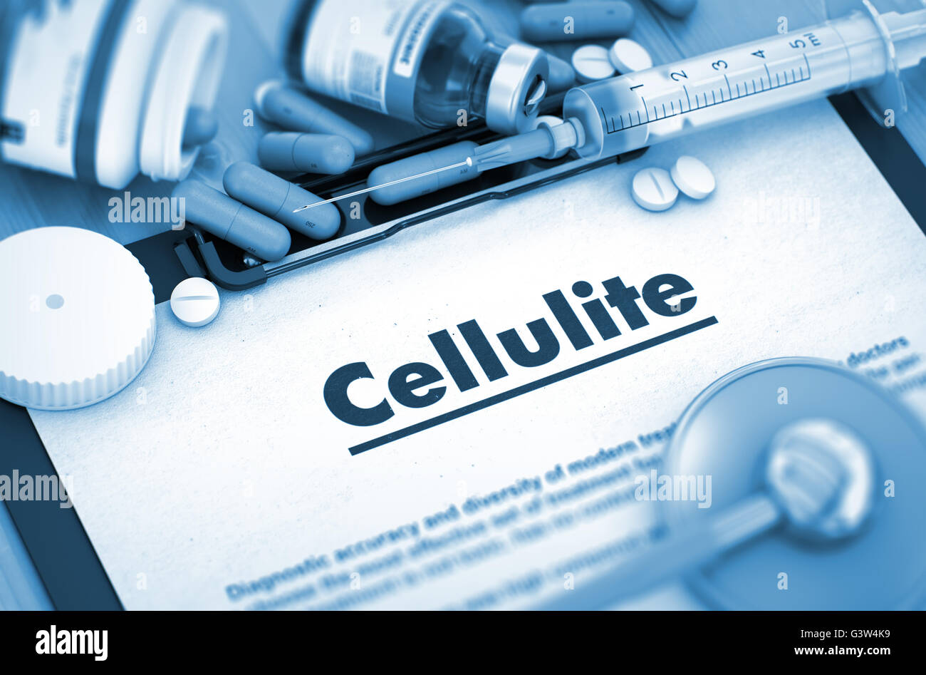 Cellulitis hi-res stock photography and images - Alamy