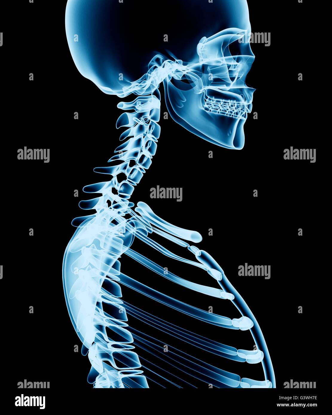 x-ray image of a man isolated on black Stock Photo - Alamy
