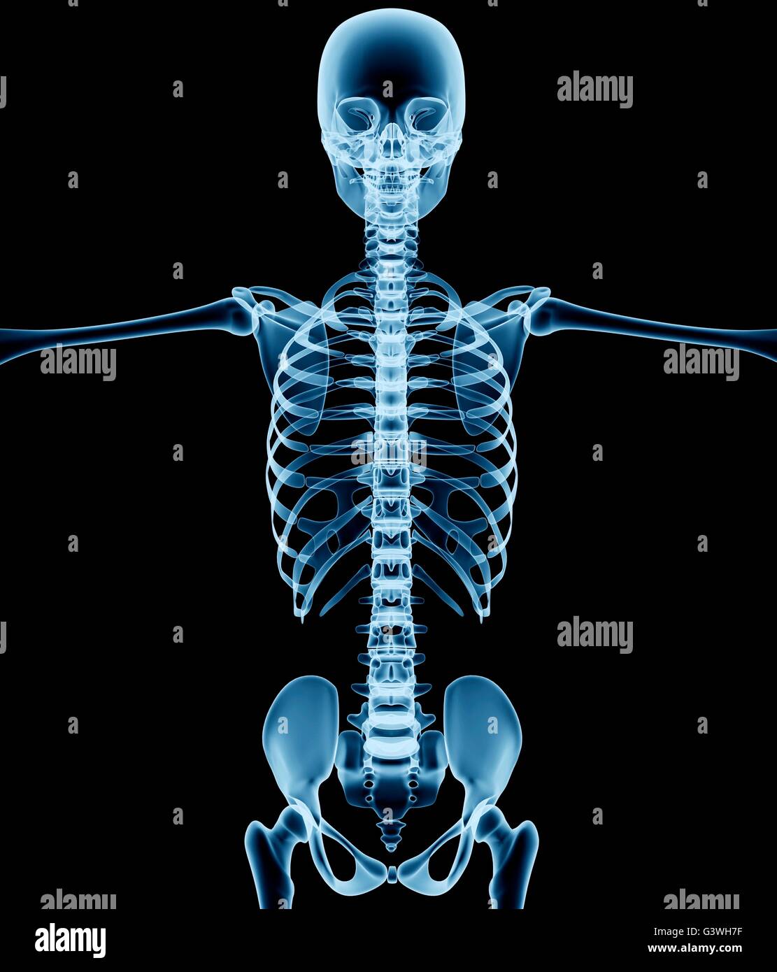 x-ray image of a man isolated on black Stock Photo - Alamy